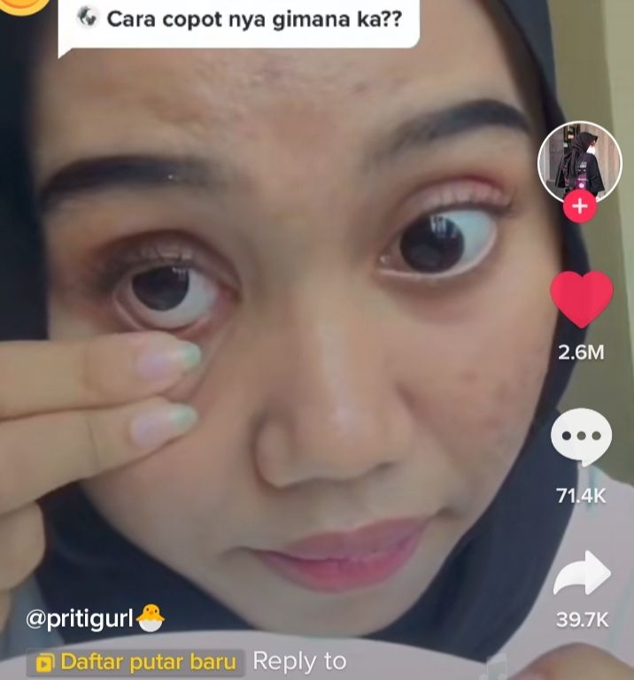 Viral Di Tiktok Seorang Wanita Tunjukkan Cara Lepas Protesa Mata